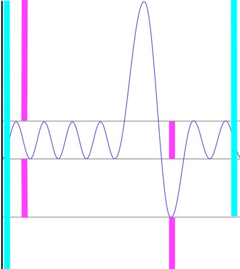 Lung Capacity Graph Diagram Quizlet
