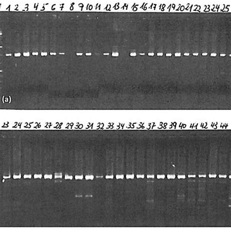 pcr gel electrophoresis of 18s small subunit ribosomal dna fragments a