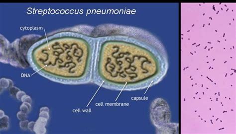 During ~ Do Not Do It End S Pneumoniae Capsule Bite Oppressor Crystal