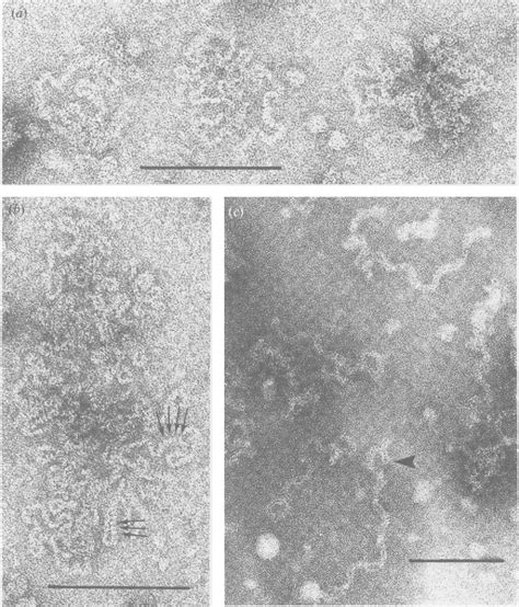 Figure I From The Closely Related Citrus Ringspot And Citrus Psorosis