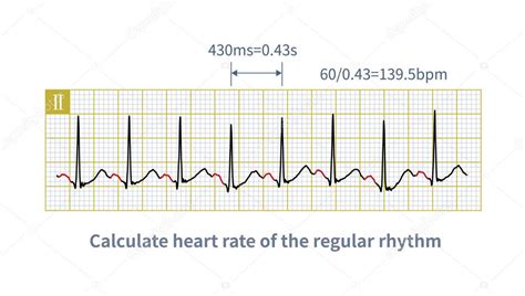 In Daily Work The Horizontal 1 Mm Represents 40 Ms Of Time In The