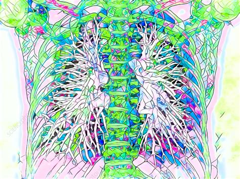 Healthy Lungs Ct Scan Stock Image C0573424 Science Photo Library