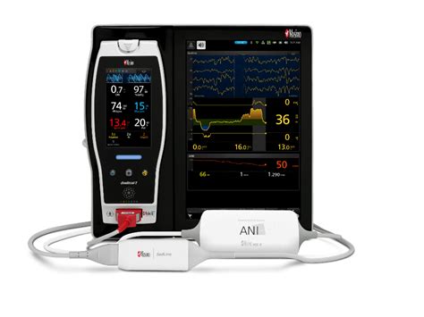 Analgesia Nociception Index Ani Santair