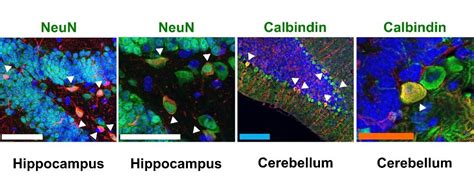 Stemcells Transdifferentiation Parkinsonsdisease Drugdiscovery