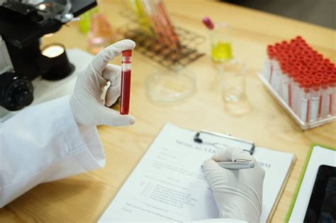 혈액 튜브 테스트를 들고 실험실 기술자 또는 의사의 손과 혈액 샘플이있는 컬러 튜브 및 현미경 랙을 배경으로 실험실의 다른 환자 Dna에 대한 스톡 사진 및 기타 이미지