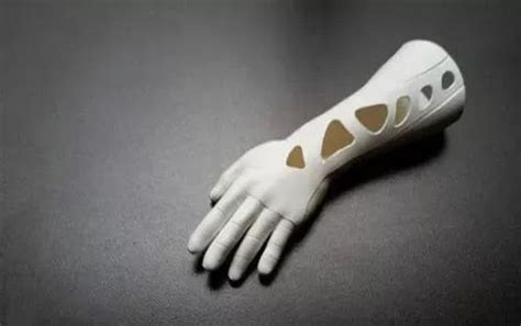 3d打印义肢 知乎