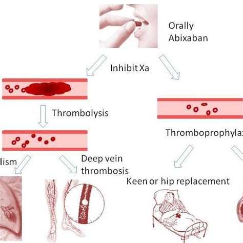 Clinical Application Of Apixaban The Application Of Apixaban In The Download Scientific