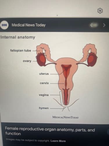 Exam 4 Lab Flashcards Quizlet