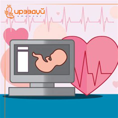 Ирээдүй эмнэлэг Ireedui Emneleg ️ Ургийн зүрхний бичлэг 32 долоо хоногоос дээш жирэмсэн