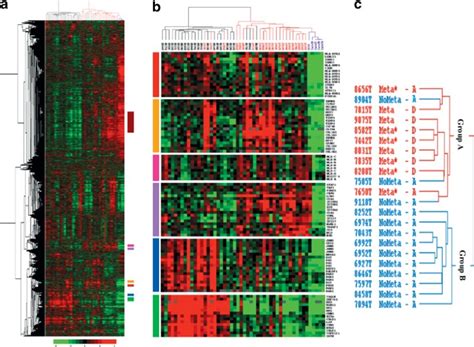 Gene Expression Profiling Of Colon Cancer By Dna Microarrays And Correlation With Histoclinical