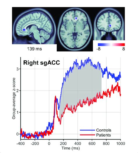 Right Sgacc Response To High Calorie Food Images Upper Row Brain