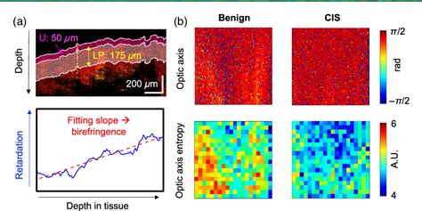 Figure 3 From Multiparameter Interferometric Polarization Enhanced Imaging Differentiates