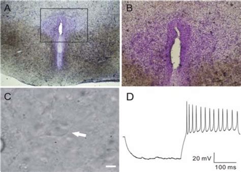The Paraventricular Nucleus And The Electrophysiological Recording From