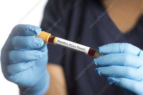 Hepatic Function Panel Blood Test Stock Image F Science Photo Library