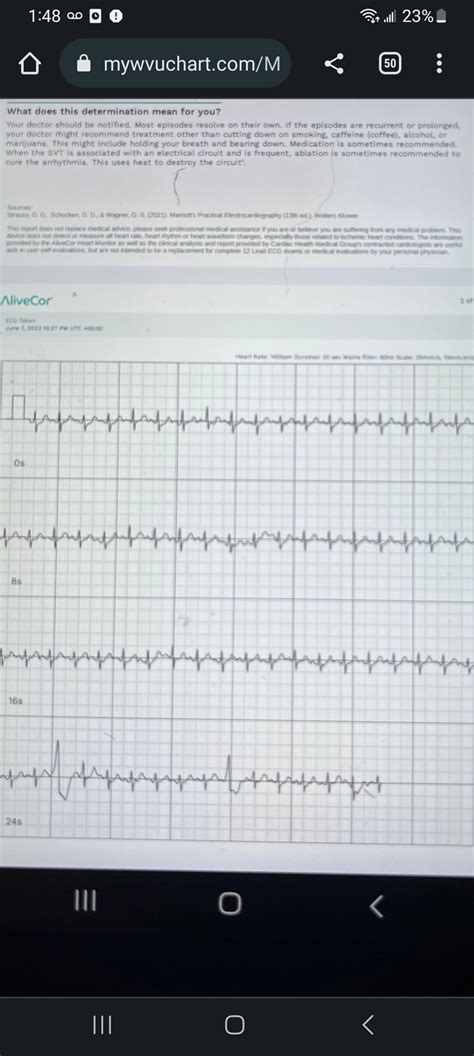 Pvcs Upon Exertionscared Rpvcs