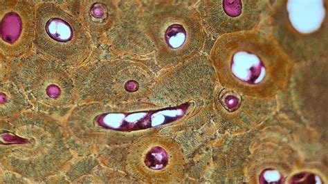 Osteocyte Microscope