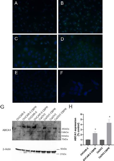 Abca1 Is Associated With The Development Of Acquired Chemotherapy Resistance And Predicts Poor