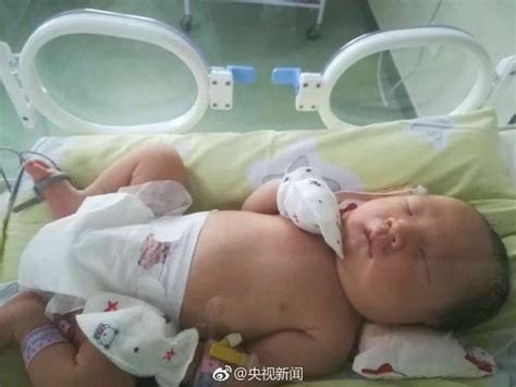 產婦臍帶脫垂 醫生跪姿托舉29分鐘 每日頭條
