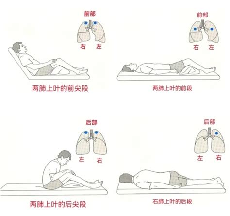 浓痰封喉却咳不出来？三招助你顺利排痰，关键时刻能救命！ 科普头条 看呼吸