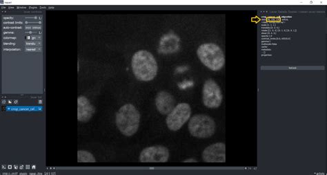 Tracking In Napari Focalplane