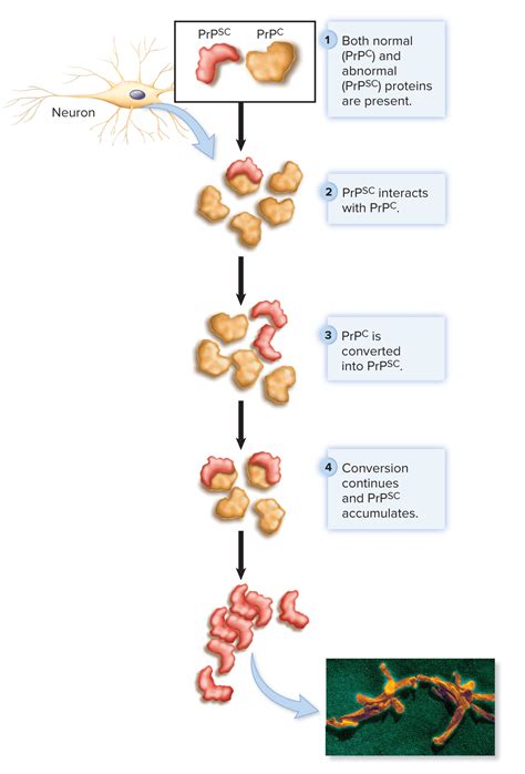 Prion Propagation Body Balance Protein Disease