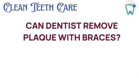 The Surprising Truth Can Dentists Remove Plaque With Braces