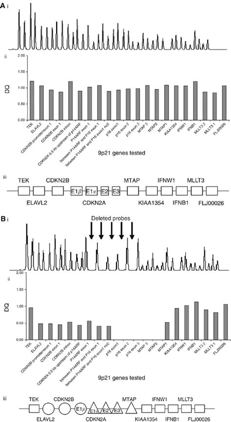Multiplex Ligation Dependent Probe Amplification Analysis Of Esft Dna Download Scientific