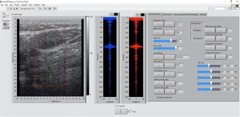 Research Beamformed Rf Data Telemed Ultrasound