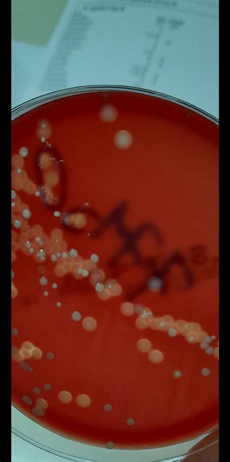 Streptococcus Agalactiae Group B Streptococci Group B Streptococcus Group B Strep Or S
