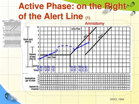 PPT Master The Partograph Essential Guide For Perinatal Care PowerPoint Presentation ID 9165825
