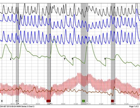 Leaked Documents Point To DIAs Inability To Detect Sophisticated Polygraph Countermeasures