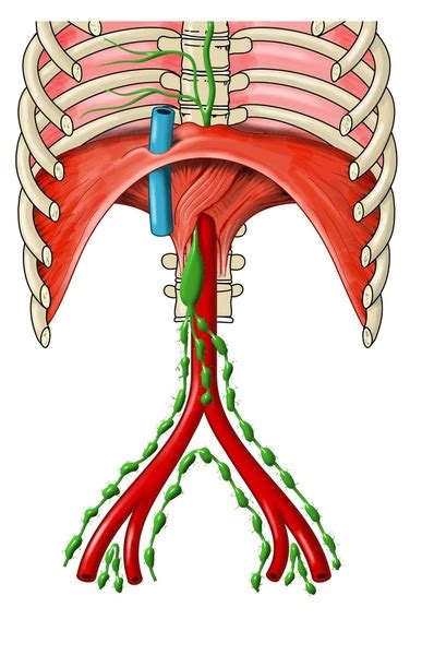 Celiac Disease Lymph Nodes