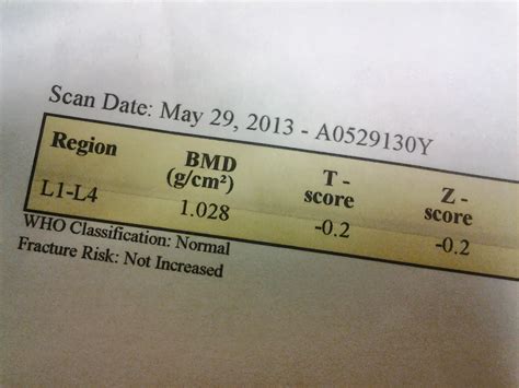 How I Complicated My Life Today DEXA Scan Bone Density Test