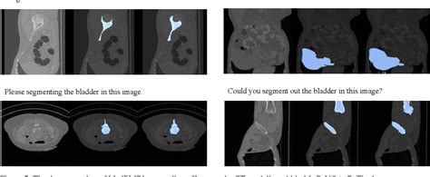 Figure 7 From Towards A Multimodal Large Language Model With Pixel Level Insight For Biomedicine