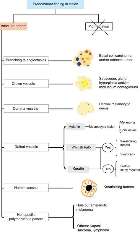 Vascular Patterns In Dermoscopy Actas Dermo Sifiliográficas