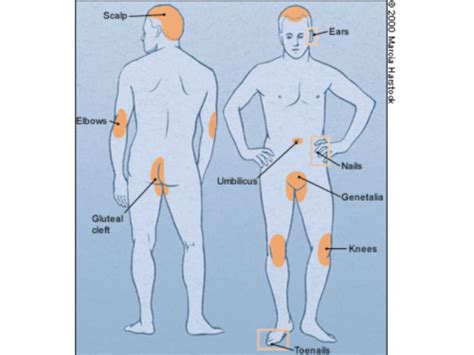 Assessment Flashcards Quizlet