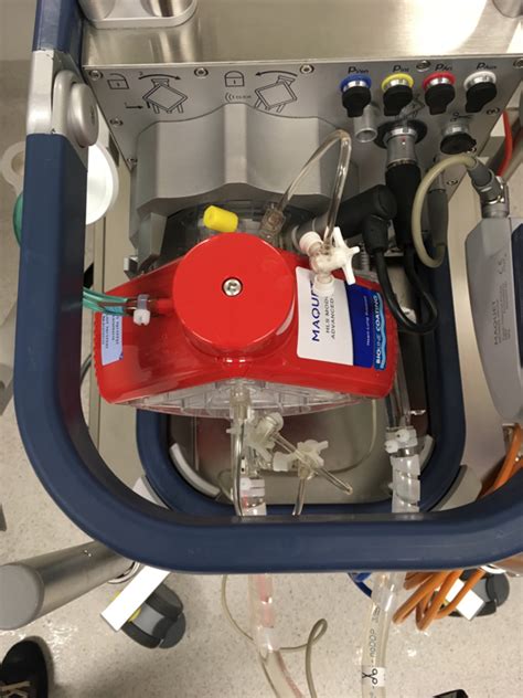 Circuit Priming Alfred Ecmo Guideline