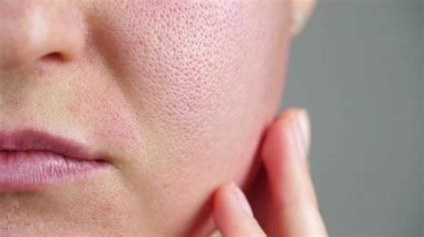 5 Causes Of Large Pores Kenyanvibe