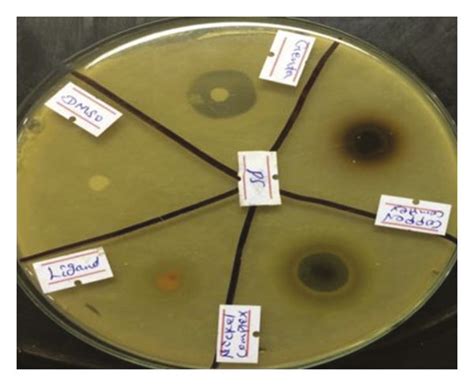 Inhibition Of Escherichia Coli A Bacillus Subtilis B Download Scientific Diagram