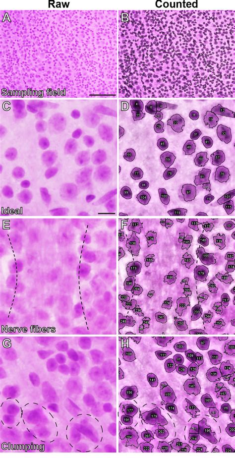 Retfm J An Imagej Based Module For Automated Counting And Quantifying Features Of Nuclei In
