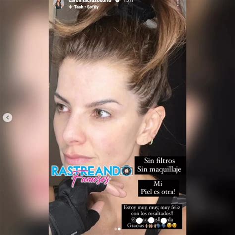 Carolina Cruz Dejó Ver Los Cambios En Su Rostro Sin Filtros Y Se Llevó Más De Un Cumplido Infobae