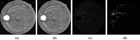 Process In Candidate Extraction A Contrast Enhancement B Download Scientific Diagram