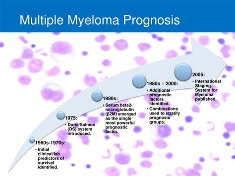 Stage 2 Multiple Myeloma Stages Of Myeloma Kfai