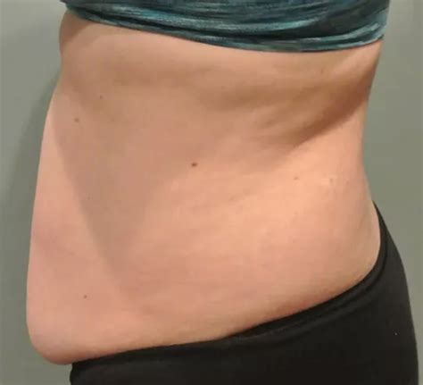 Results Archive Amy Brenner MD Associates