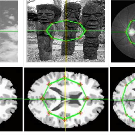 Proposed Schematic For Automation Of Srg Segmentation Download Scientific Diagram