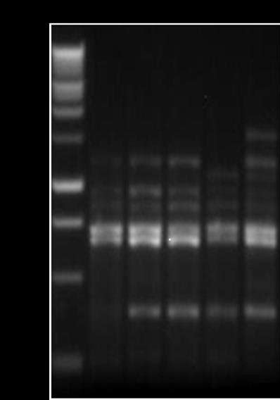 Genotyping Of Streptococcus Mutans Isolates By Ap Pcr With The Primer Download Scientific