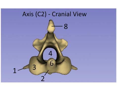 Axis C2 Cranial View Quiz