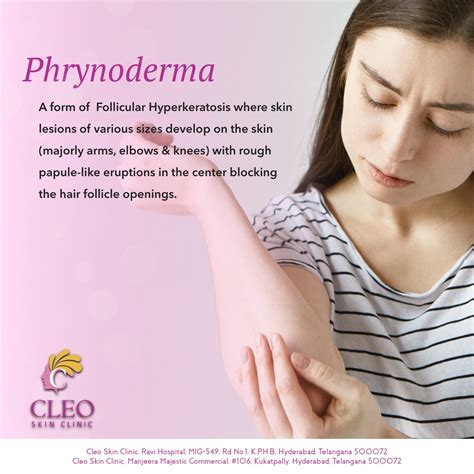 Follicular Hyperkeratosis