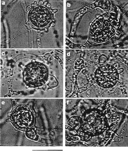 Reproductive Structures Of Pythium Regulare A Terminal Ornamented
