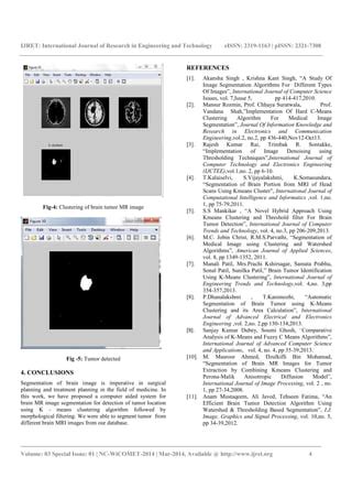 Brain Tumor Mri Image Segmentation And Detection PDF